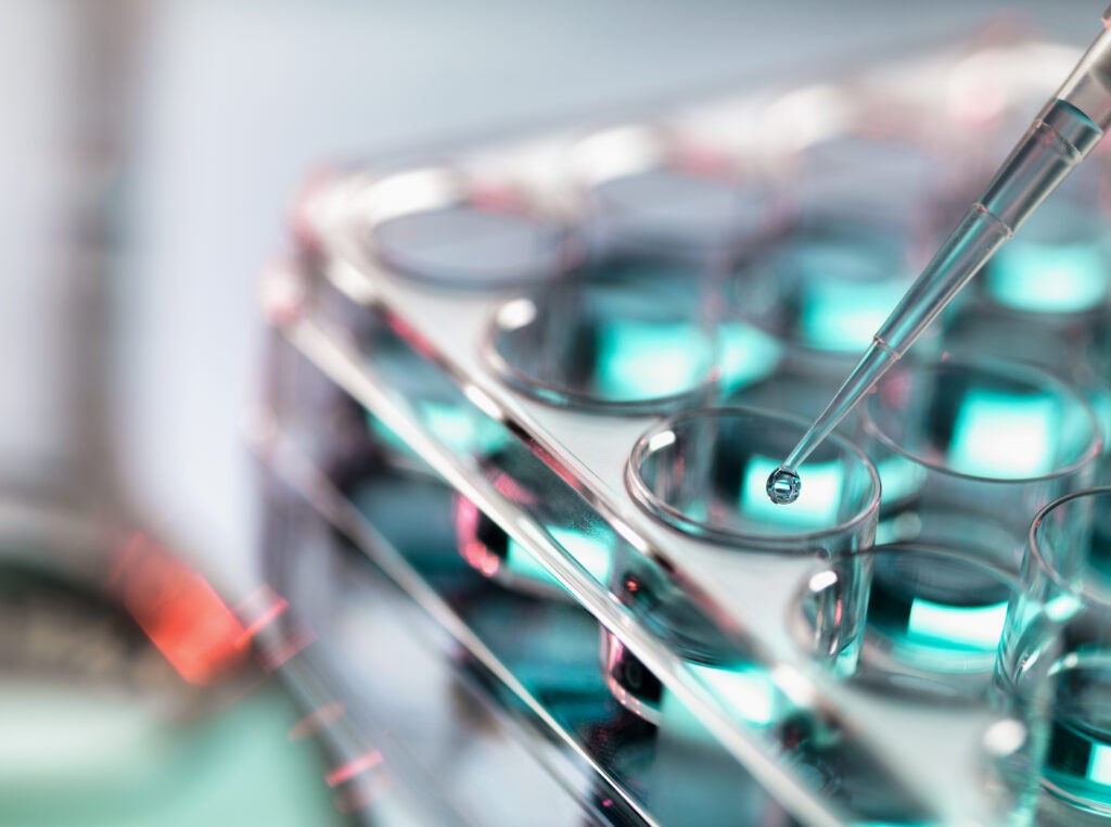 Esperion Therapeutics CEO Sheldon Koenig | Clarivate